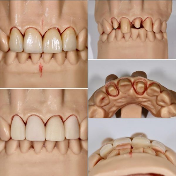 PP Face Design เมื่อทันตกรรม+ศัลยกรรม เปลี่ยนเป็น Digital | 3DD Digital ...