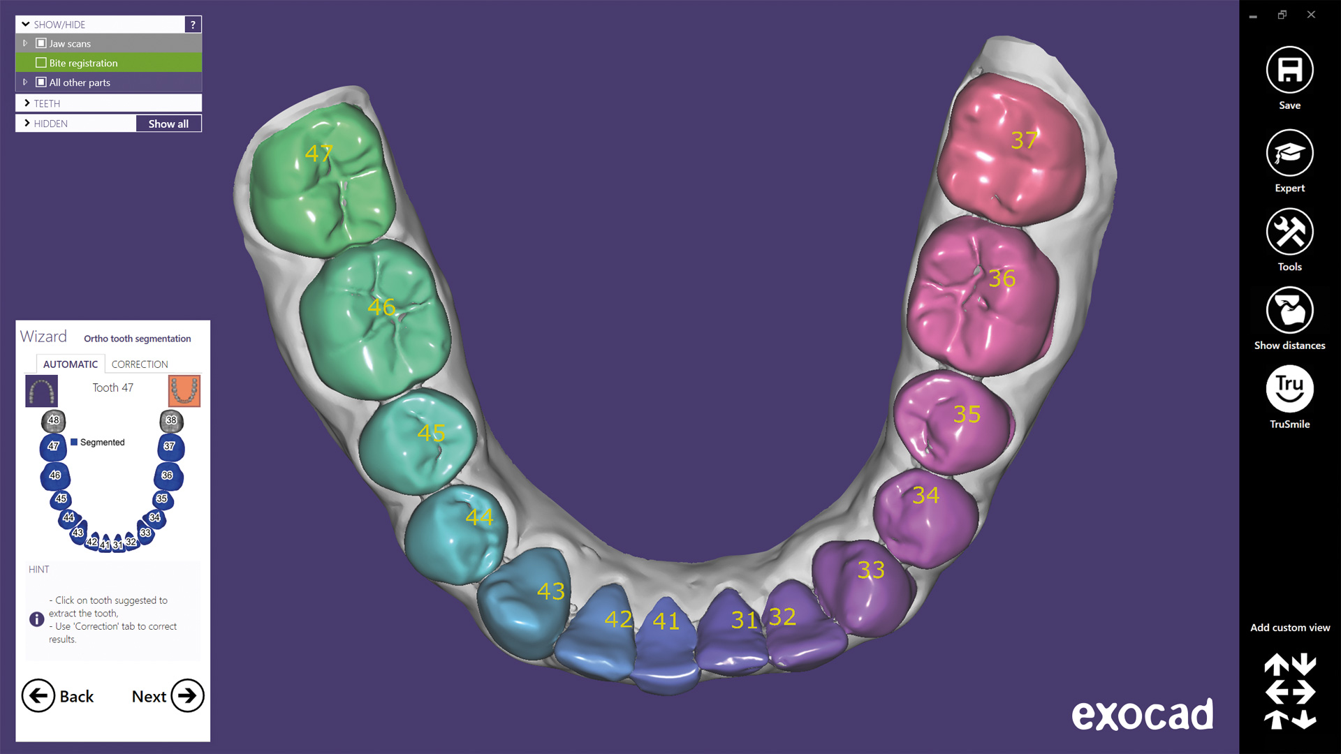 ExoCAD (Digital Dentistry) | 3DD Digital Fabrication เครื่องพิมพ์3มิติ ...