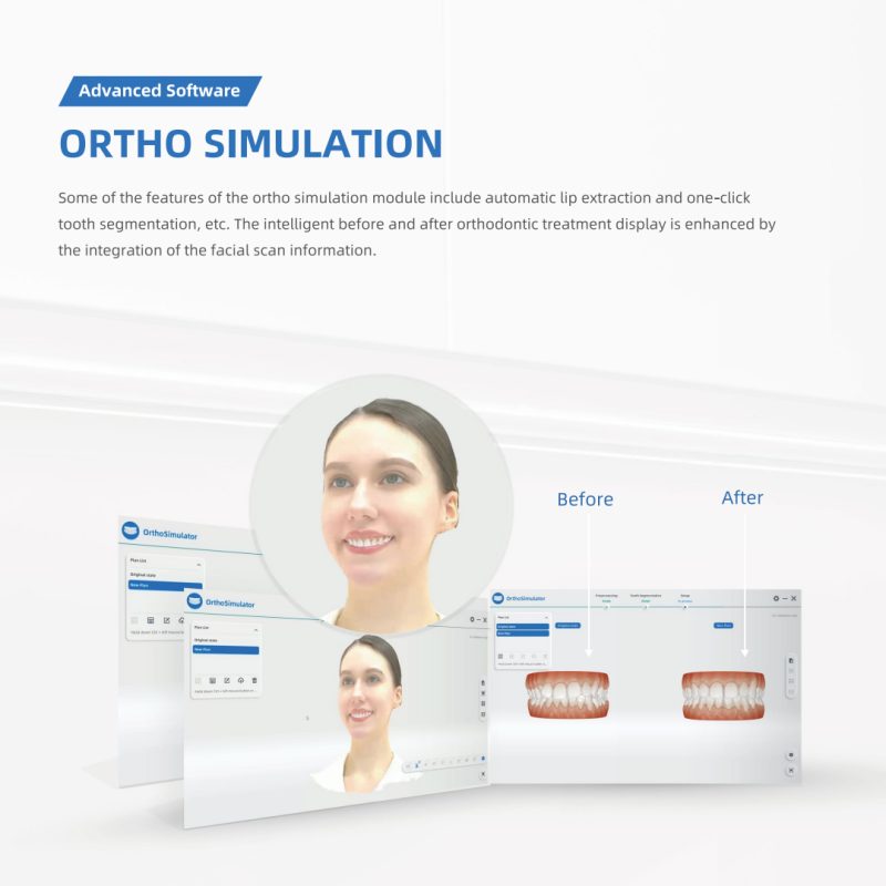 MetiSmile Dental Face 3D Scanner – เครื่องสแกนใบหน้าสำหรับงานทันตกรรม ...