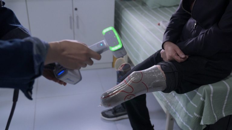 ปฏิวัติวงการ O&P(Orthotics & Prosthetics) ด้วยเทคโนโลยี 3D สแกนกับ EinScan H2 และ EXScan | 3DD ...